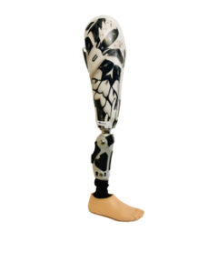 Prothèse Trans-Fémorale - amputation fémorale, manchon, emboiture ...